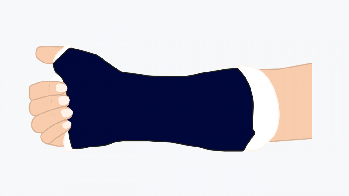 Kahnbeinfraktur: Die 7 wichtigsten Themen bei einem Bruch im Handgelenk ...